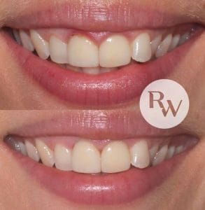 Periodontist Near Me - Specialist Gum Clinic | London - RW Perio